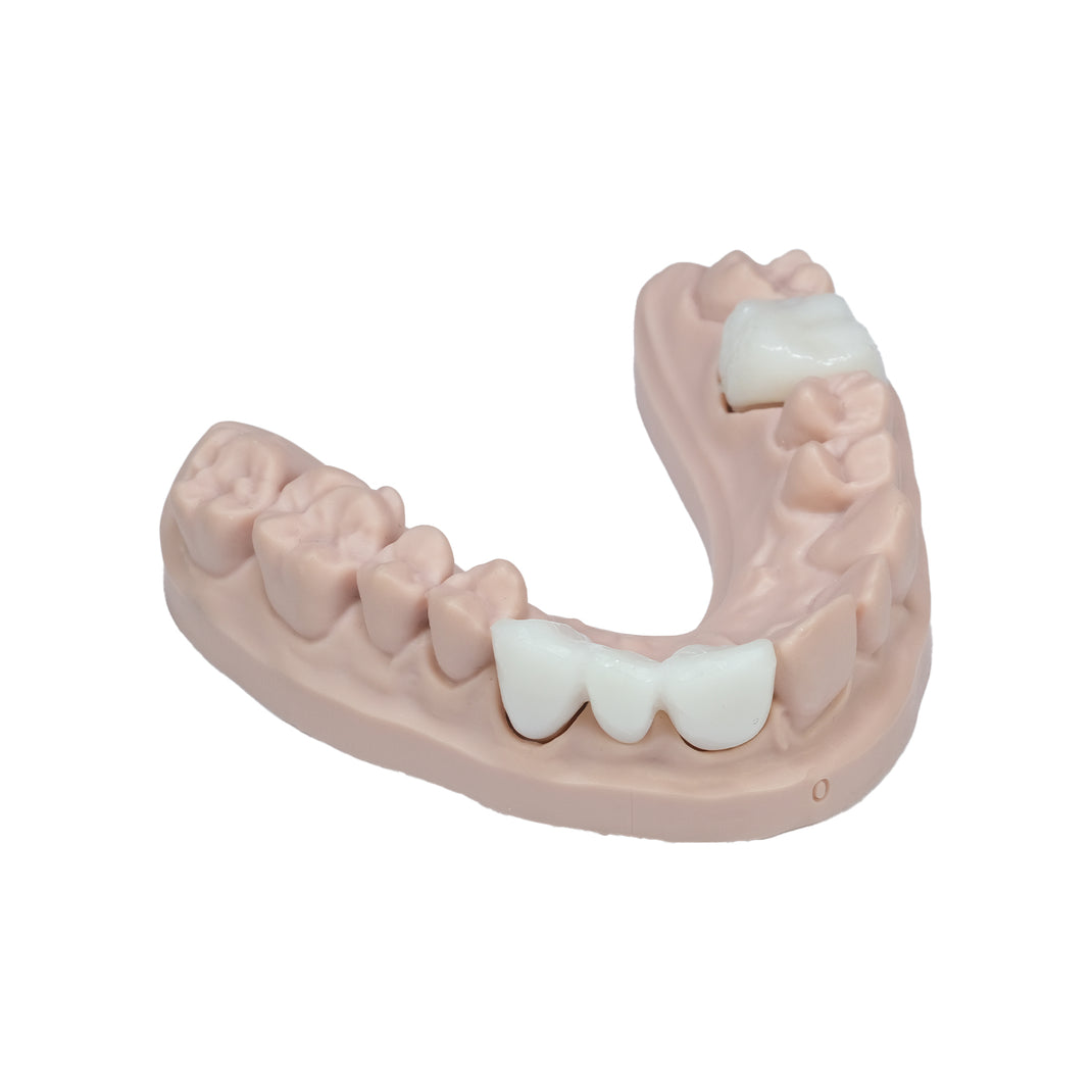 Top 3D Printing Resins for Jewelry & Dental | PowerResins